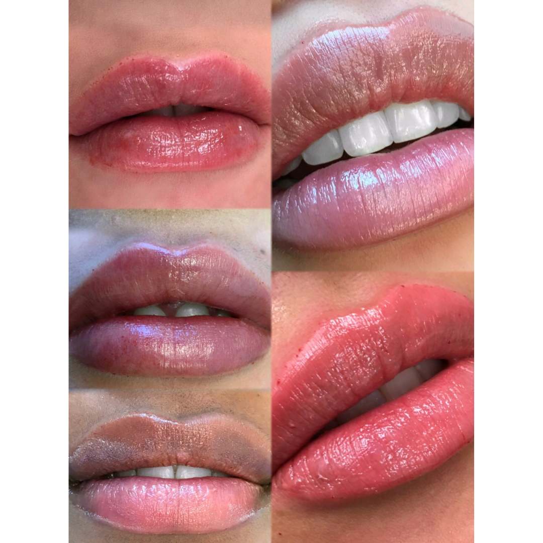 Book Custom Lip Augmentation Package | California Cosmetics