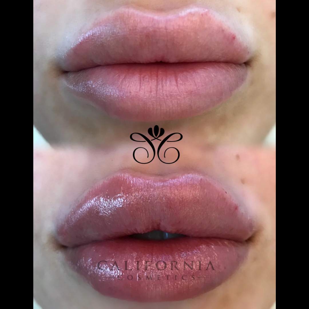 Book Kissable Lips Lip Filler Package | California Cosmetics