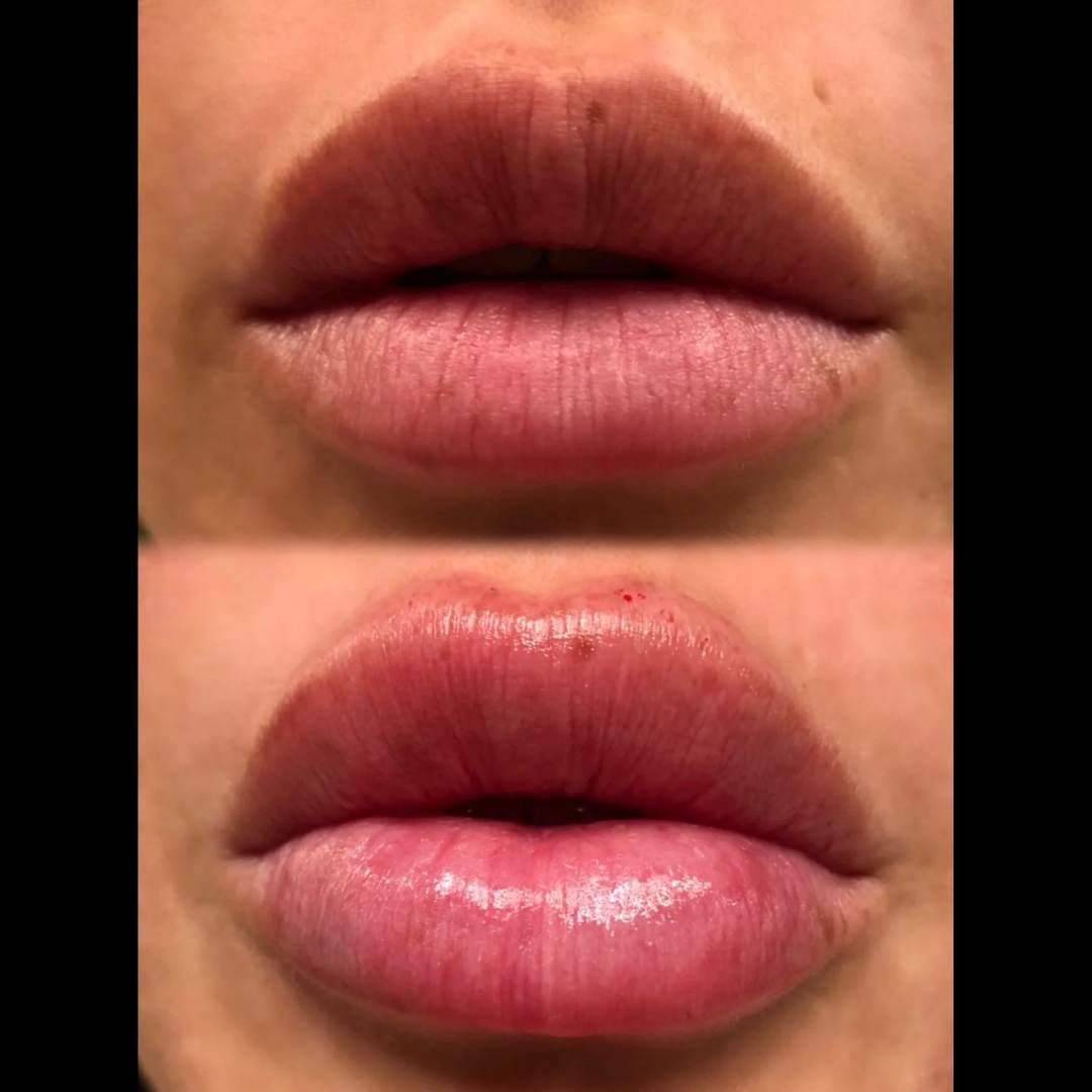 Book Kissable Lips Lip Filler Package | California Cosmetics