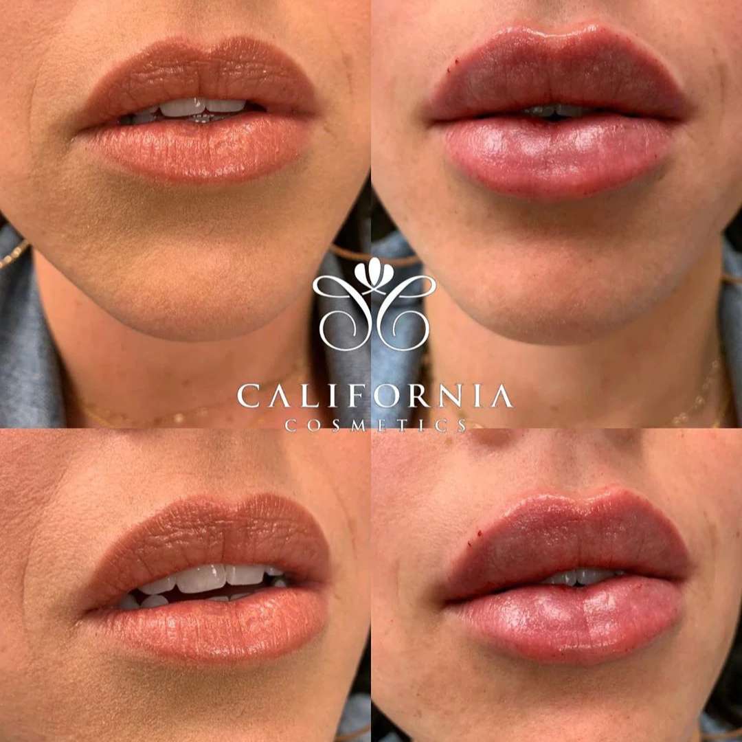Book Kissable Lips Lip Filler Package | California Cosmetics