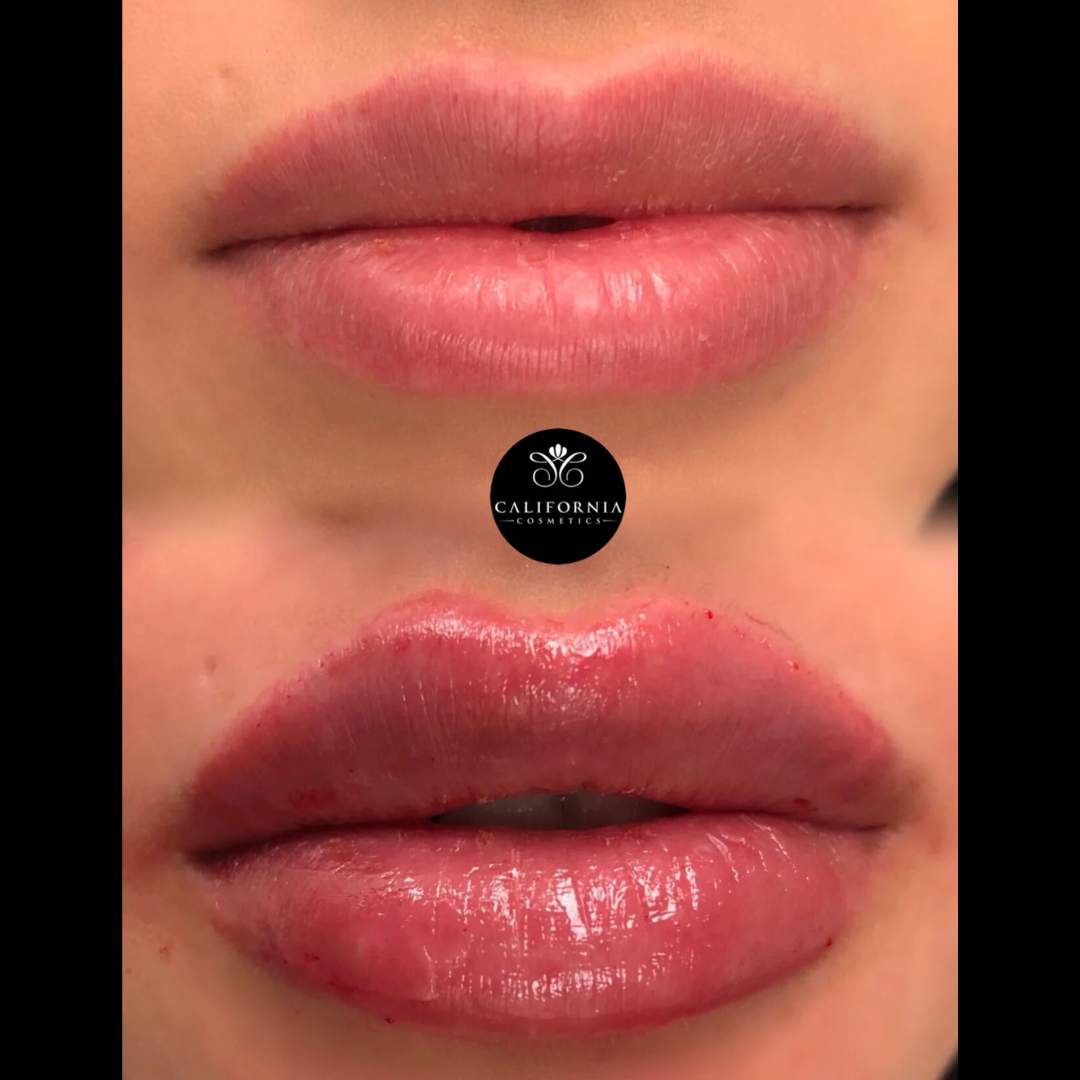 Book Kissable Lips Lip Filler Package | California Cosmetics