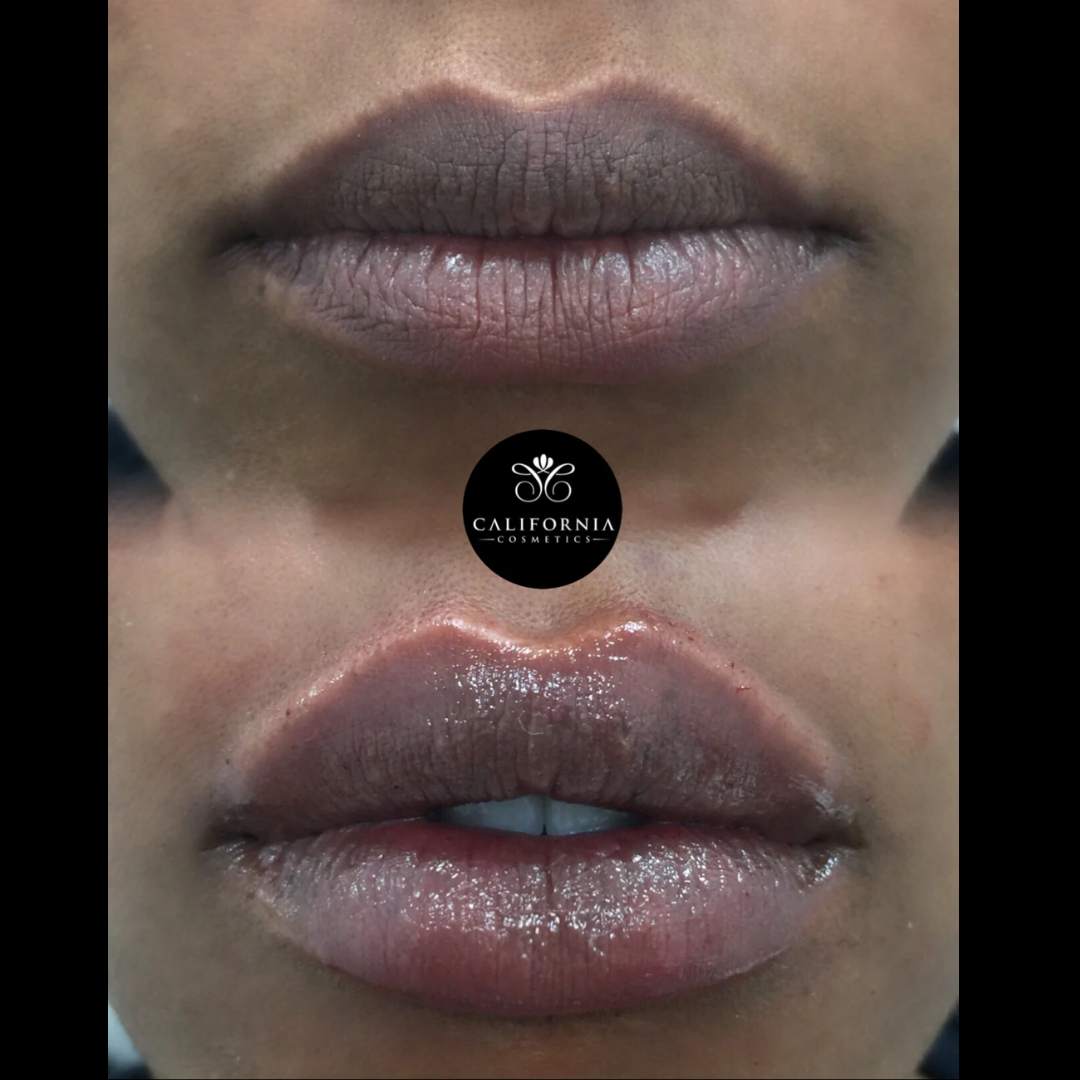 Book Kissable Lips Lip Filler Package | California Cosmetics