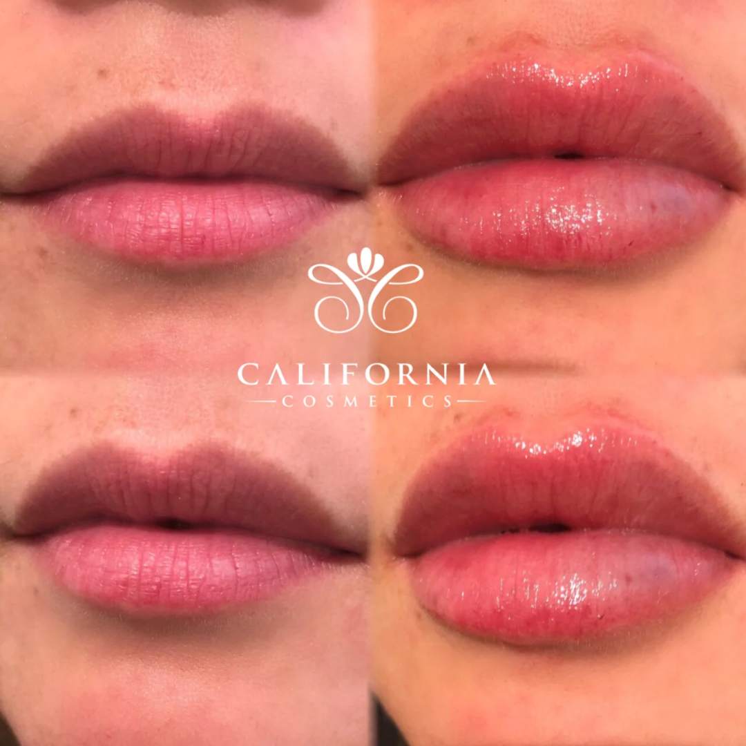 Book Kissable Lips Lip Filler Package | California Cosmetics