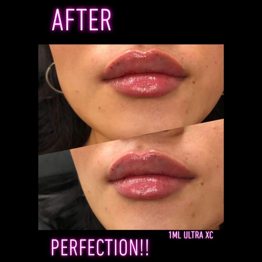 Book Kissable Lips Lip Filler Package | California Cosmetics