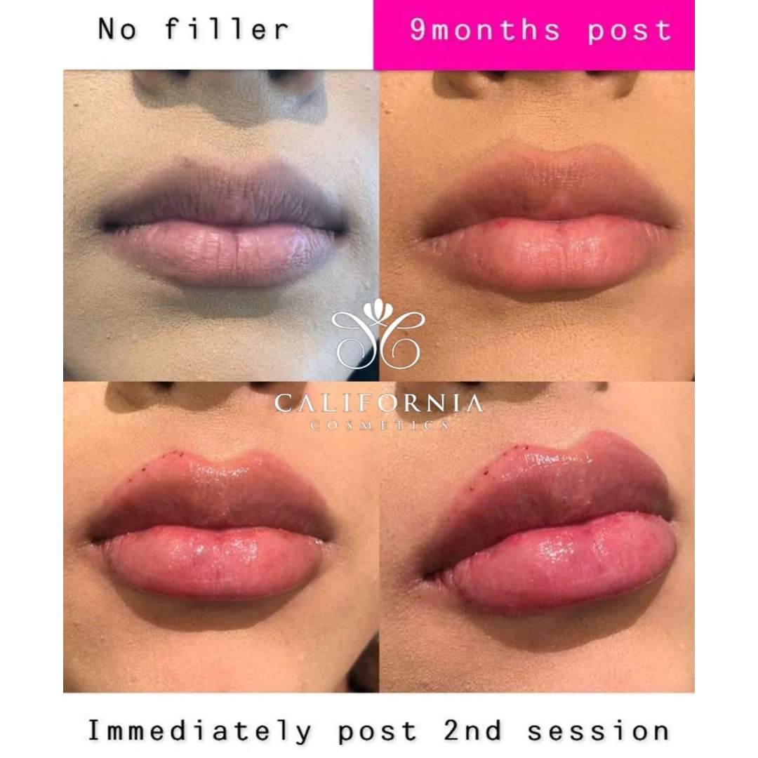 Book Kissable Lips Lip Filler Package | California Cosmetics