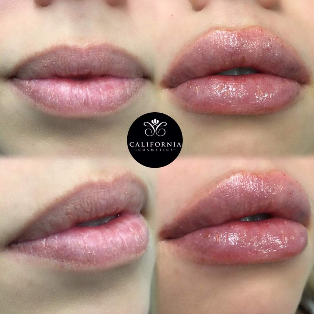 Book Kissable Lips Lip Filler Package | California Cosmetics